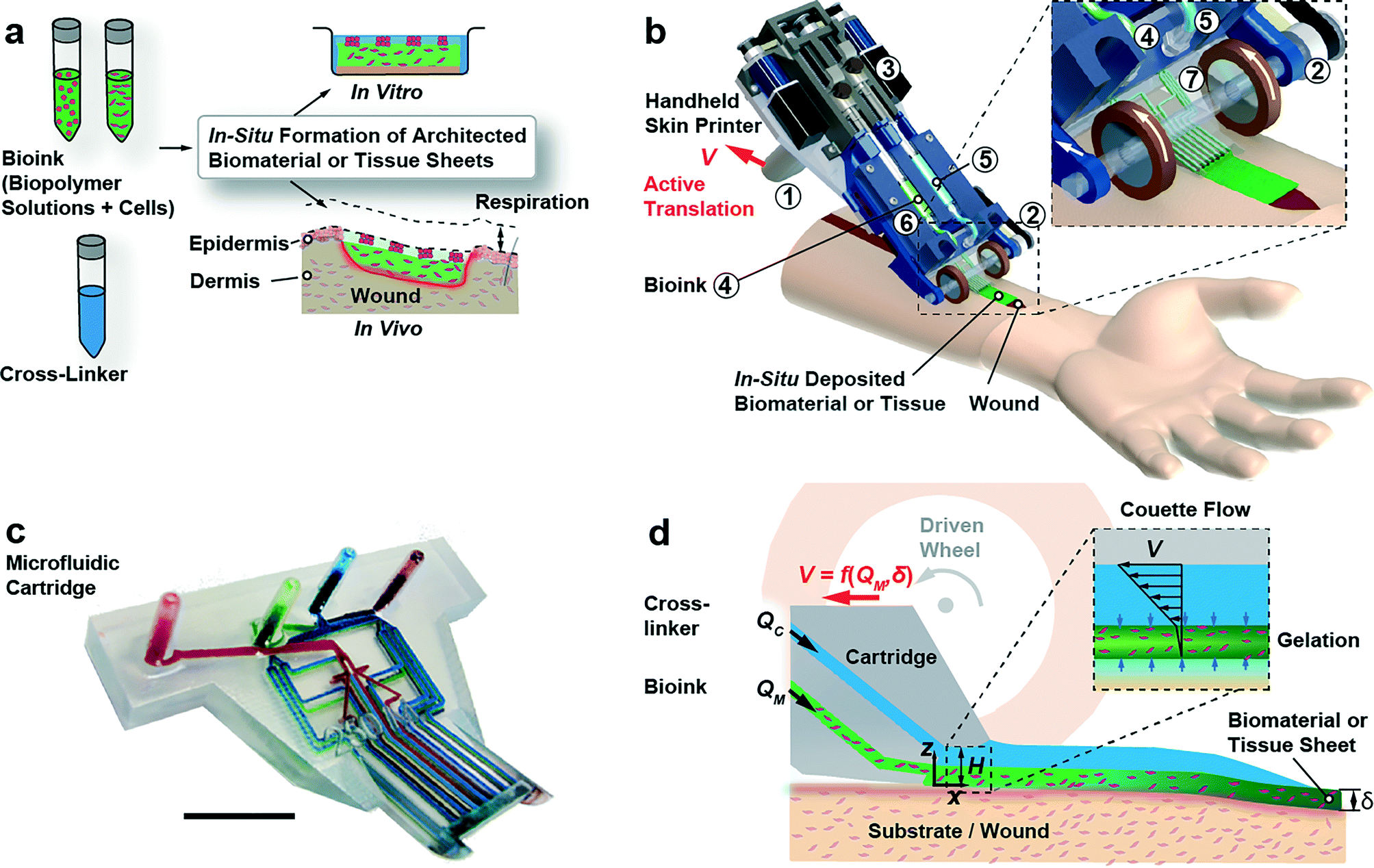 Handheld 3D Printer Delivers Skin-Precursor Sheets Directly to Full ...
